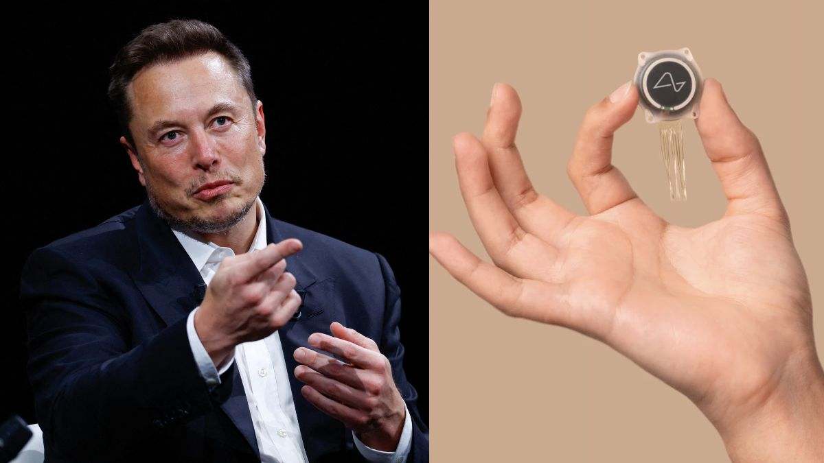 Elon Musk Acaba De Implantar Por Primera Vez Un Chip En El Cerebro De